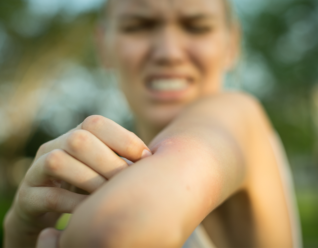 What You Need to Know About Those Itchy Mite Bites - Montgomery ...